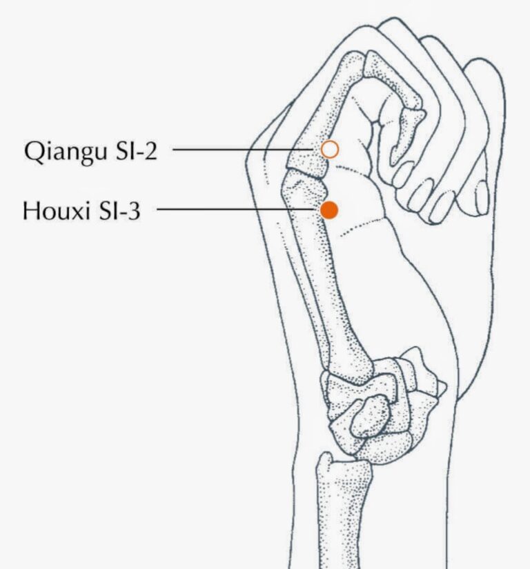 Effective Acupressure Points to Relieve Headaches Naturally | Radiant ...