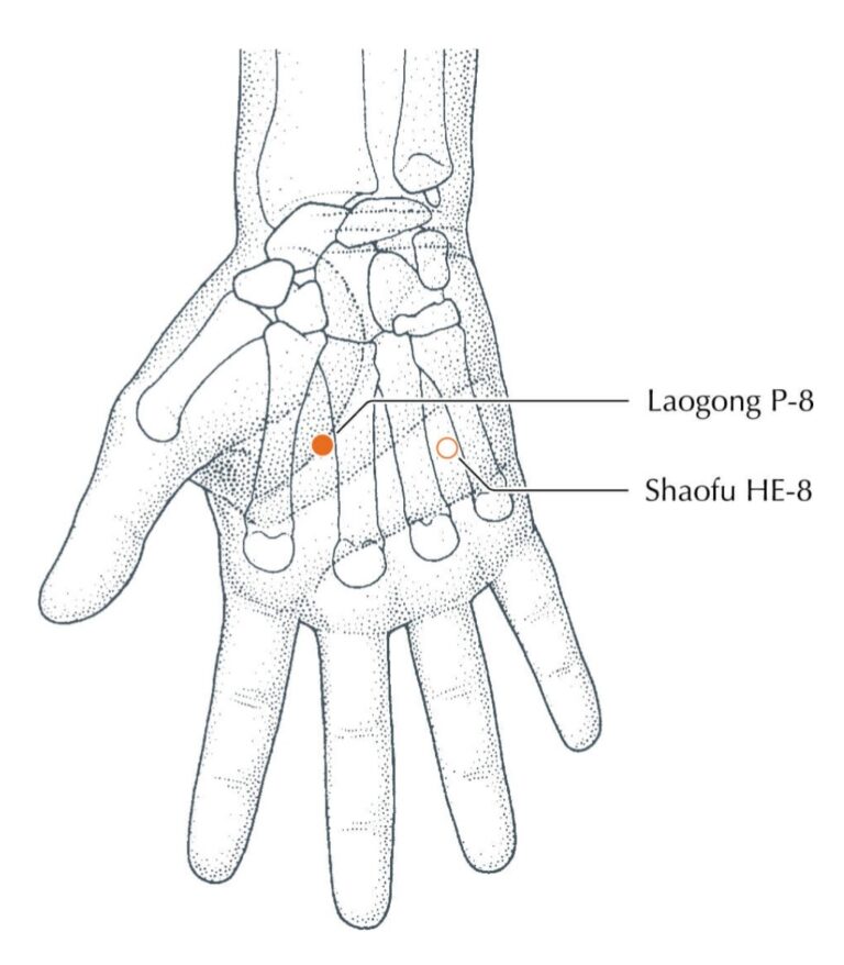 Effective Acupressure Points to Relieve Headaches Naturally | Radiant ...