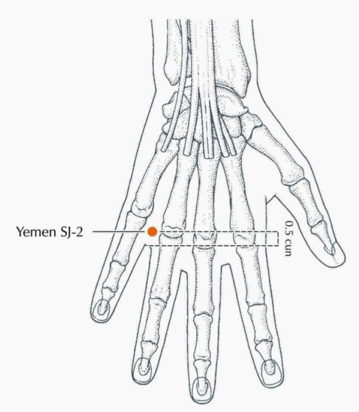Effective Acupressure Points to Relieve Headaches Naturally | Radiant ...