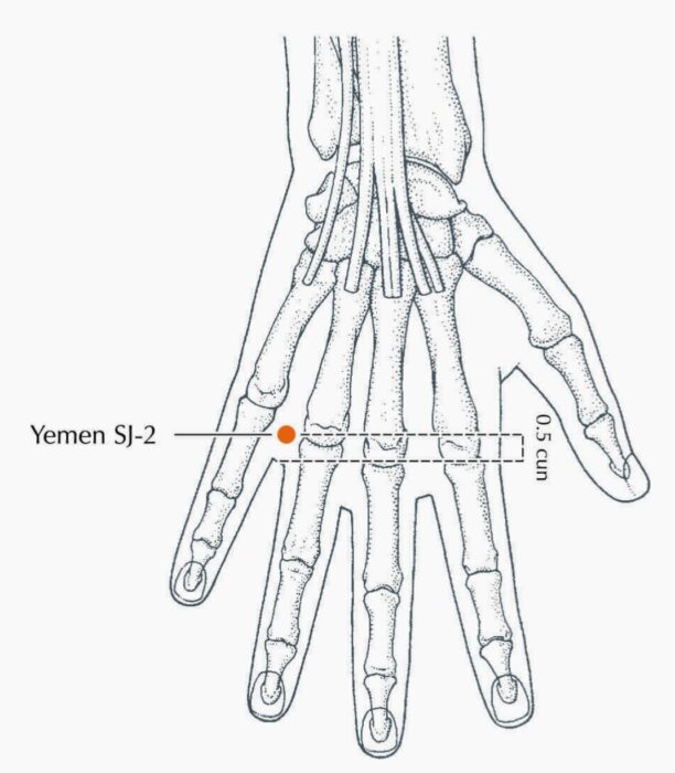 Effective Acupressure Points to Relieve Headaches Naturally | Radiant ...