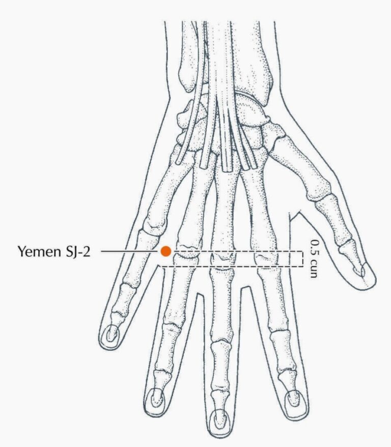 Effective Acupressure Points to Relieve Headaches Naturally | Radiant ...