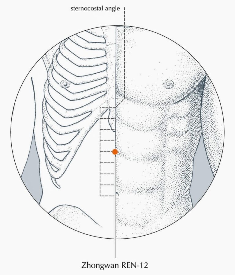 Effective Acupressure Points to Relieve Headaches Naturally | Radiant ...