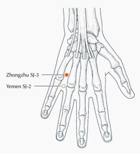 Effective Acupressure Points to Relieve Headaches Naturally | Radiant ...